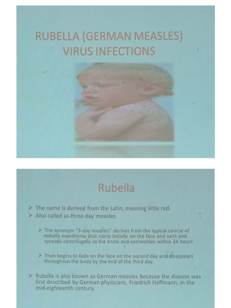 7 Rubella | PDF