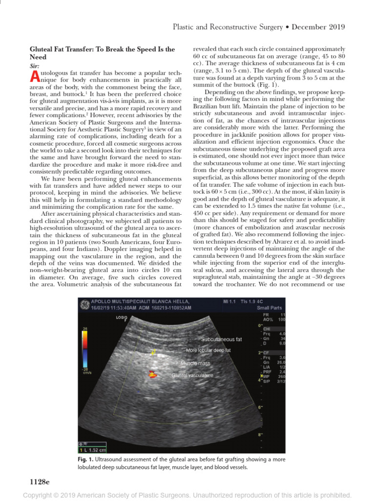 Gluteal Fat Transfer To Break The Speed Is The.80 | PDF | Clinical ...