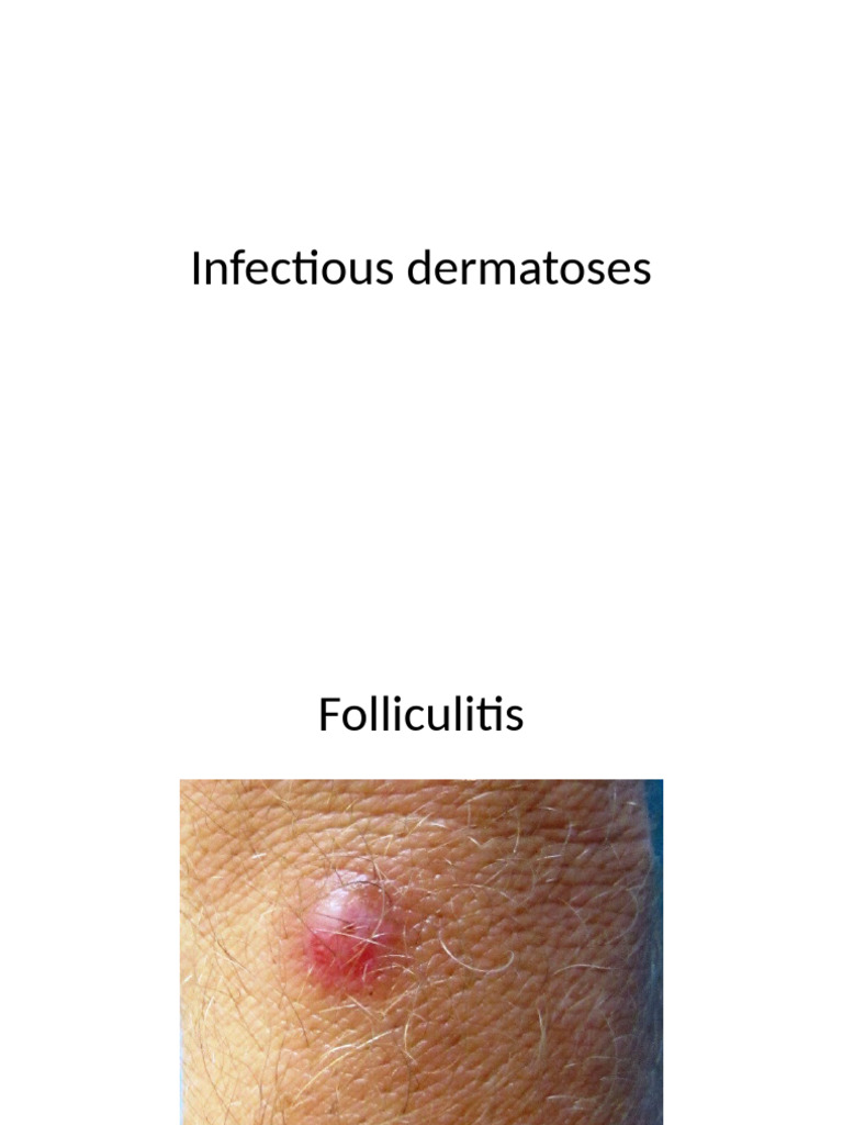 Infectious Dermatoses Examination | PDF