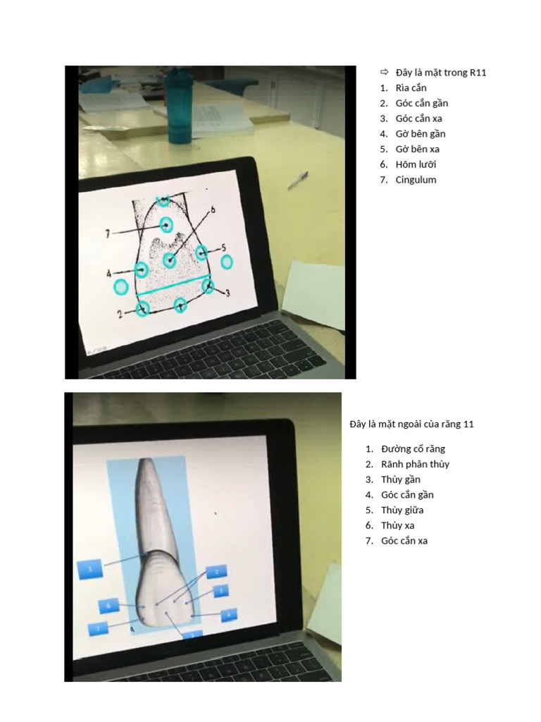 Giải phẫu răng hình ảnh Autosaved | PDF