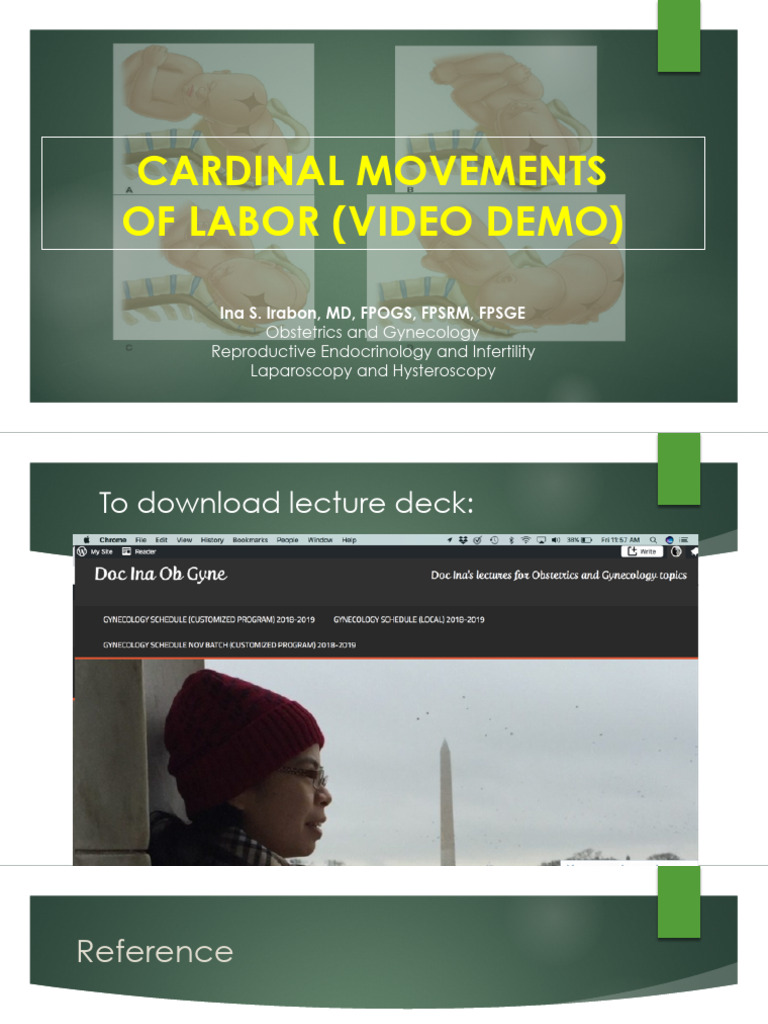 Cardinal Movements of Labor Video Guide 2 | PDF | Pelvis | Childbirth