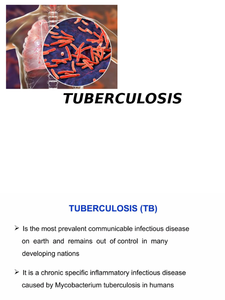 TUBERCULOSIS ppt | PDF