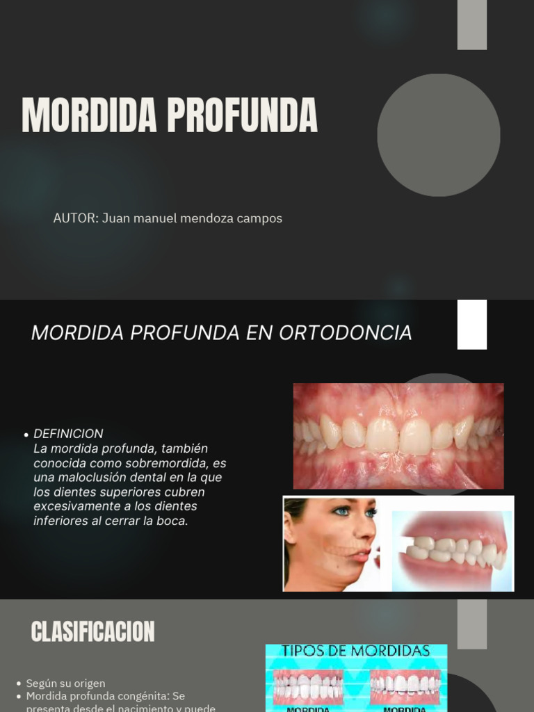 MORDIDA PROFUNDA___.pptx (1) | PDF