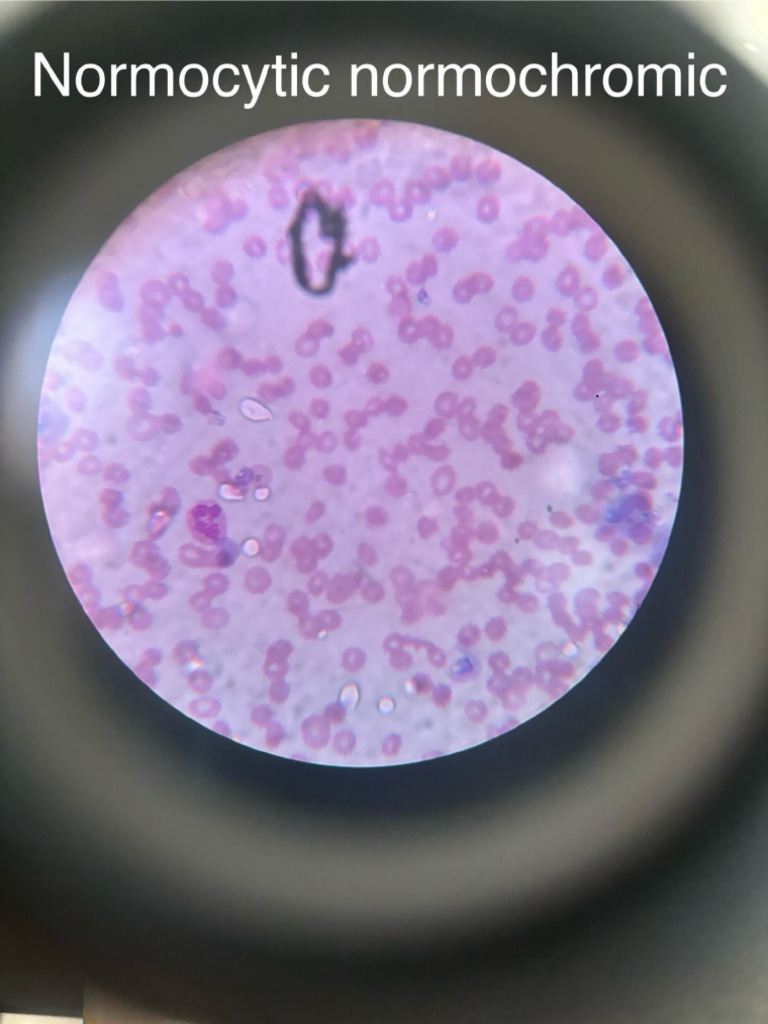 Final slides pathology | PDF