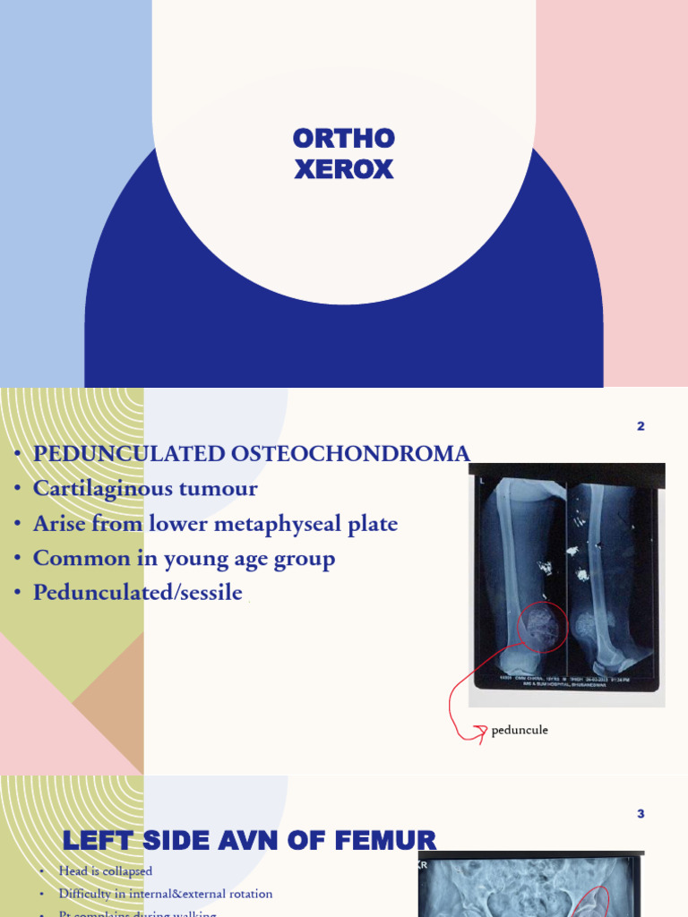 ORTHO | PDF | Hip | Pelvis