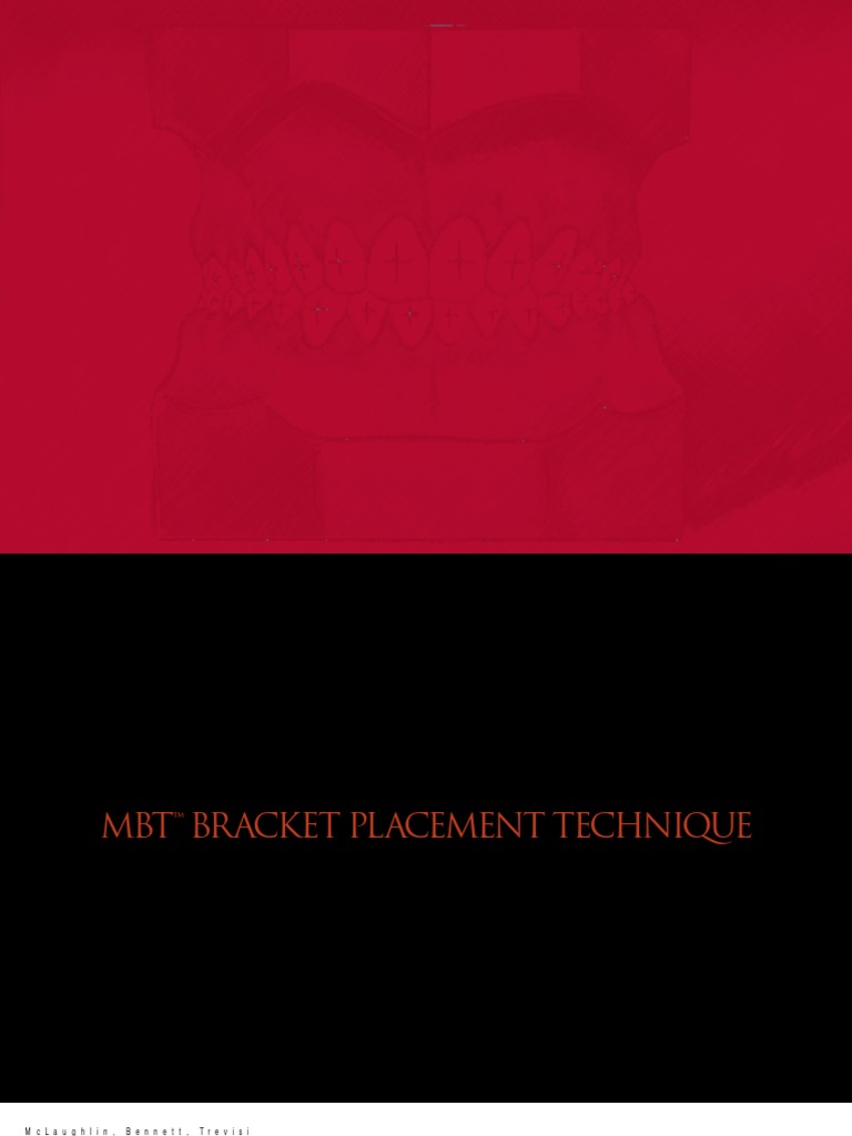 Bracket Position | PDF | Tooth | Orthodontics
