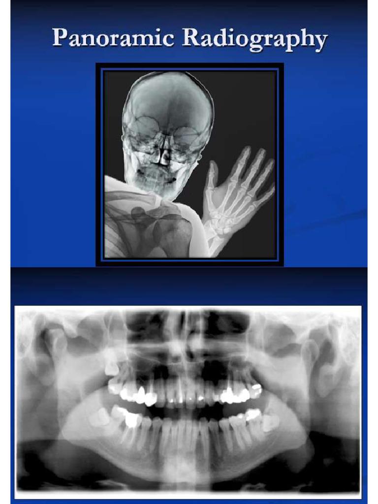 Panoramic Radiography Part 2 | PDF