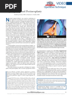 McCall Culdoplasty Procedure Overview | PDF | Vagina | Surgical Specialties
