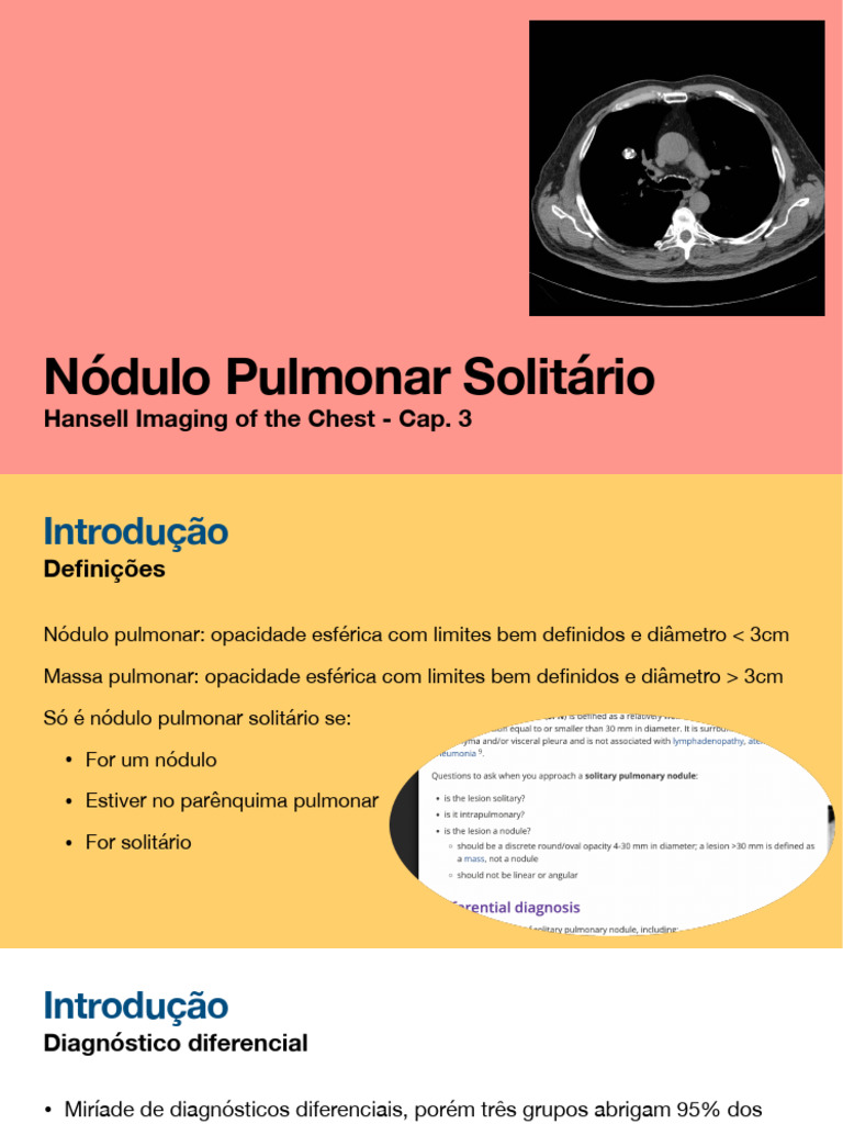 4 - Nódulo Pulmonar Solitário | PDF | Neoplasmas | Câncer