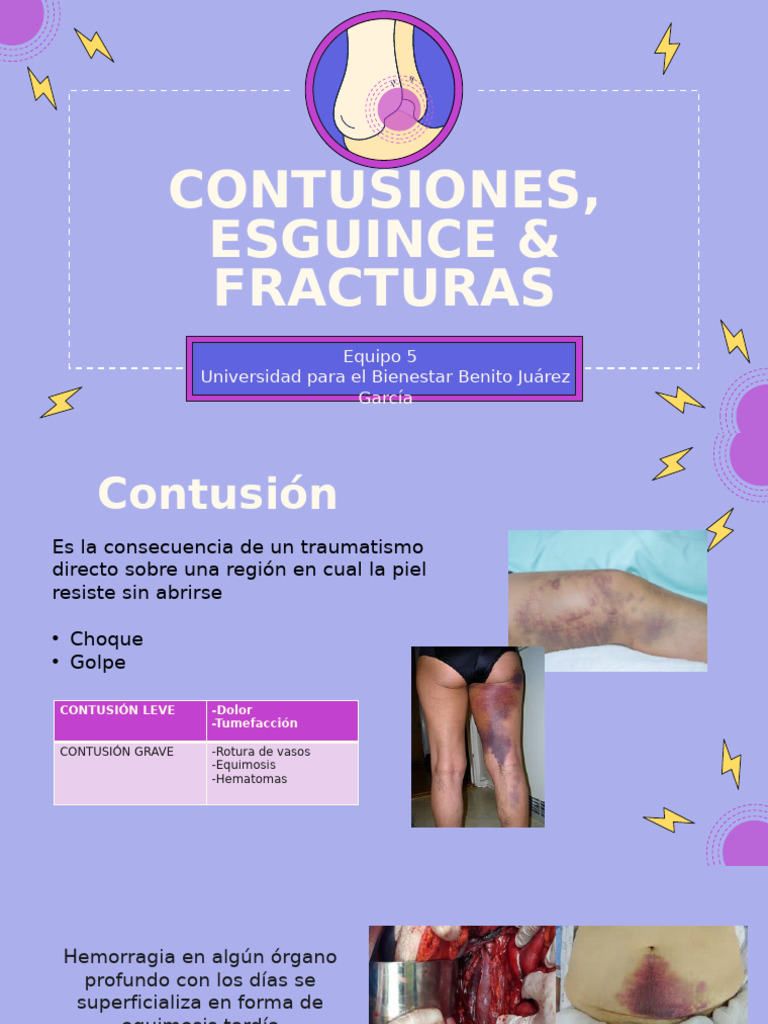 Contusiones, Esguince & Fracturas | PDF | Hueso | Rodilla