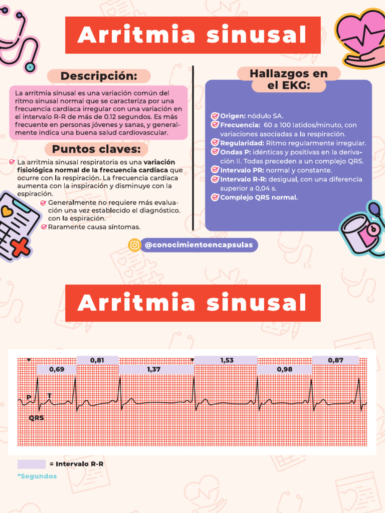 Ekg Flashcards 1 | PDF