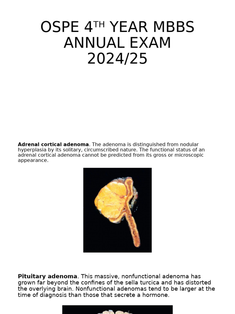 Ospe 4th Year Mbbs Annual Exam 2024 Collective | PDF | Esophagus | Thyroid