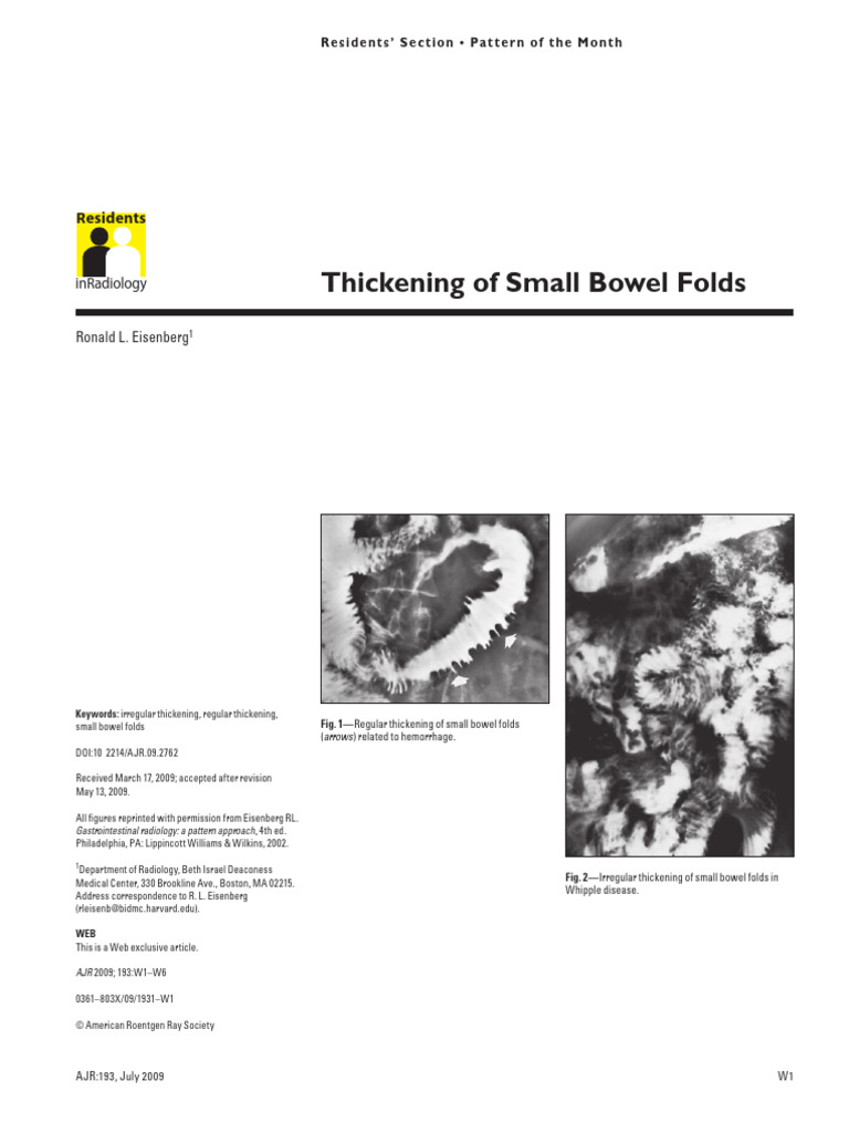Thickened Small Bowel Folds | PDF | Gastrointestinal Tract | Crohn's ...