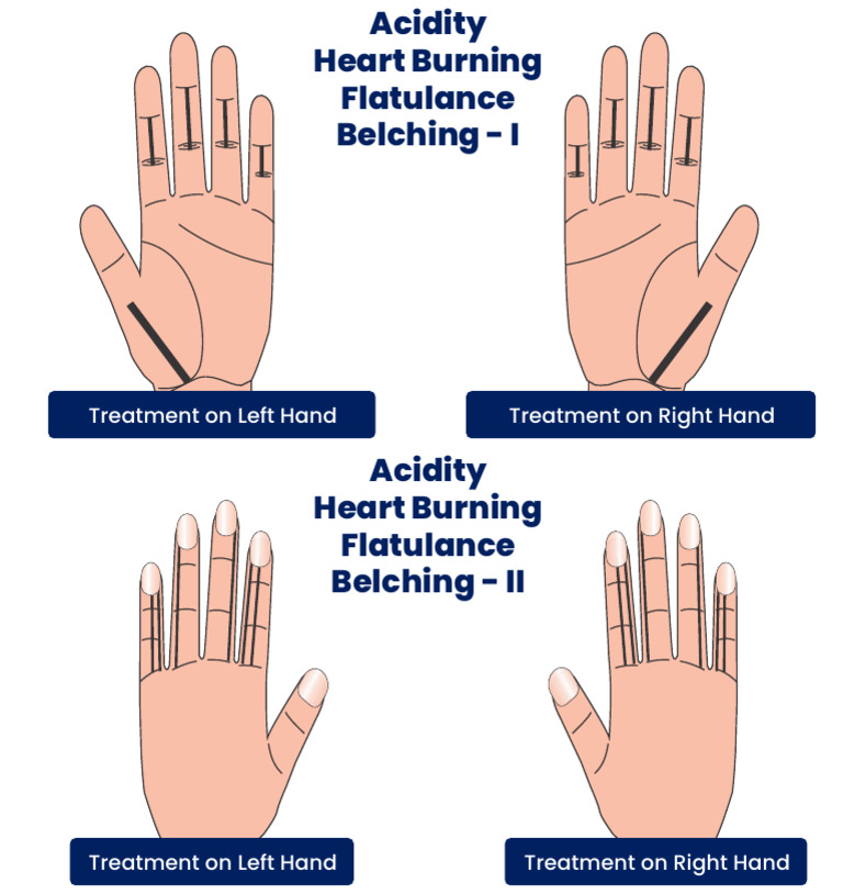 Colour Treatment fo rAcidity | PDF
