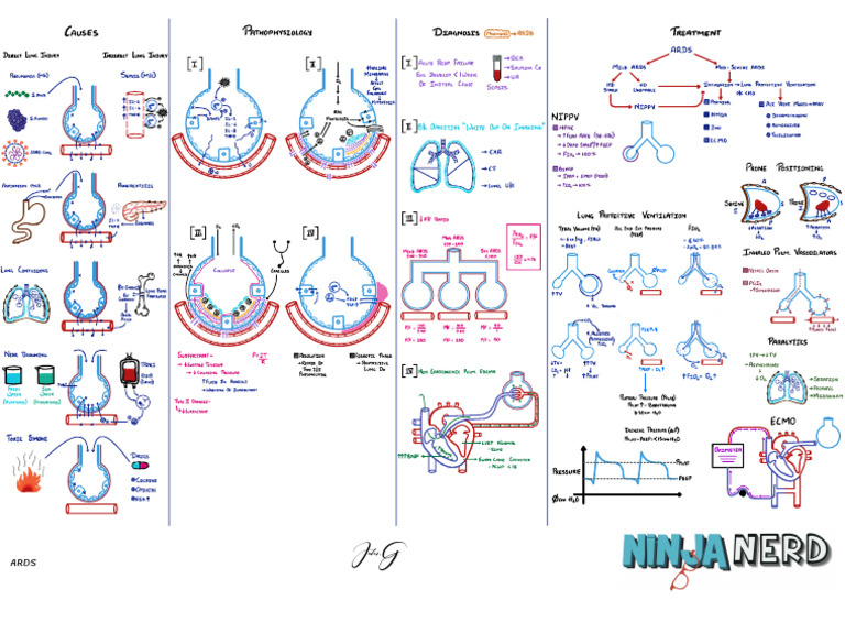 ARDS Illustration atf | PDF