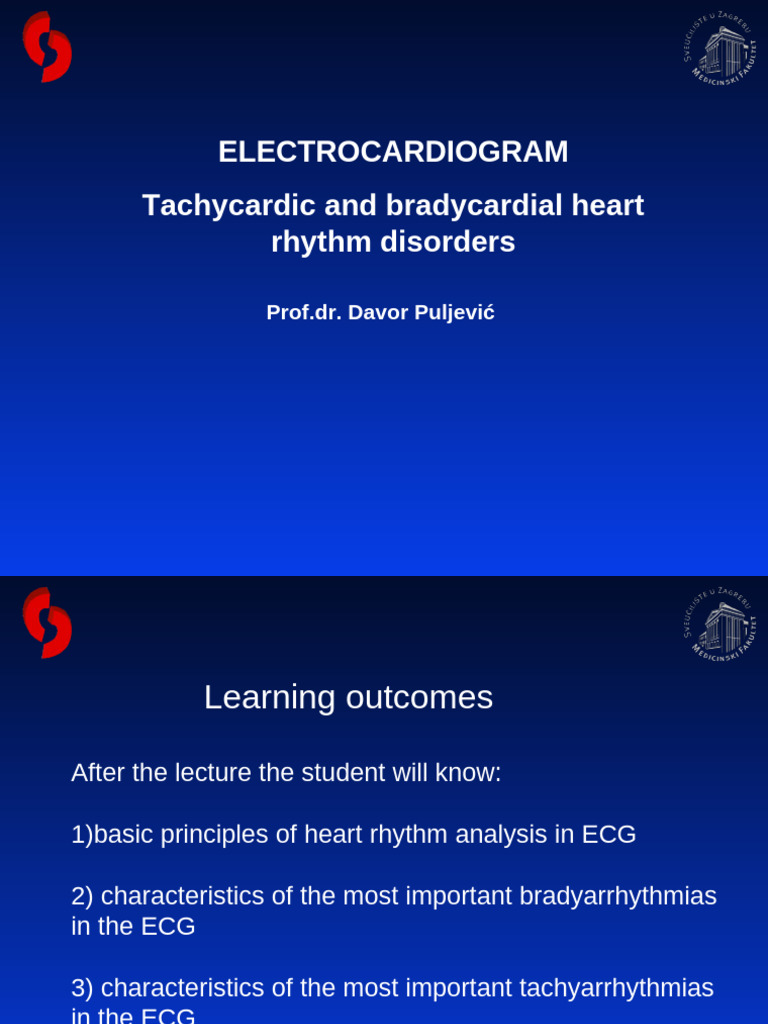(Puljevic Davor) ECG Brady and TachyarrhythmiasPart1 | PDF