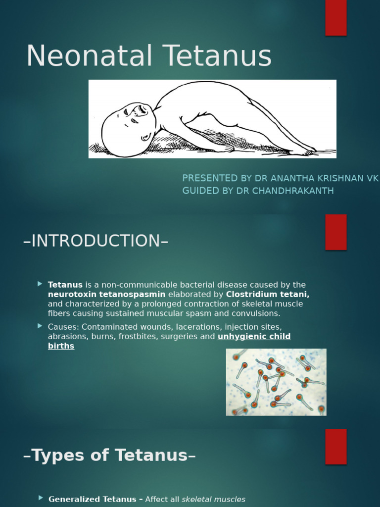 General Seminar Neonatal Tetanus 2 1 | PDF | Medical Specialties ...