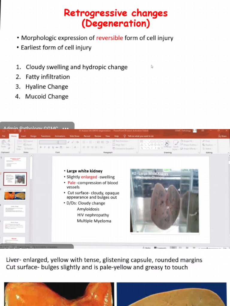 Pathology Gross | PDF