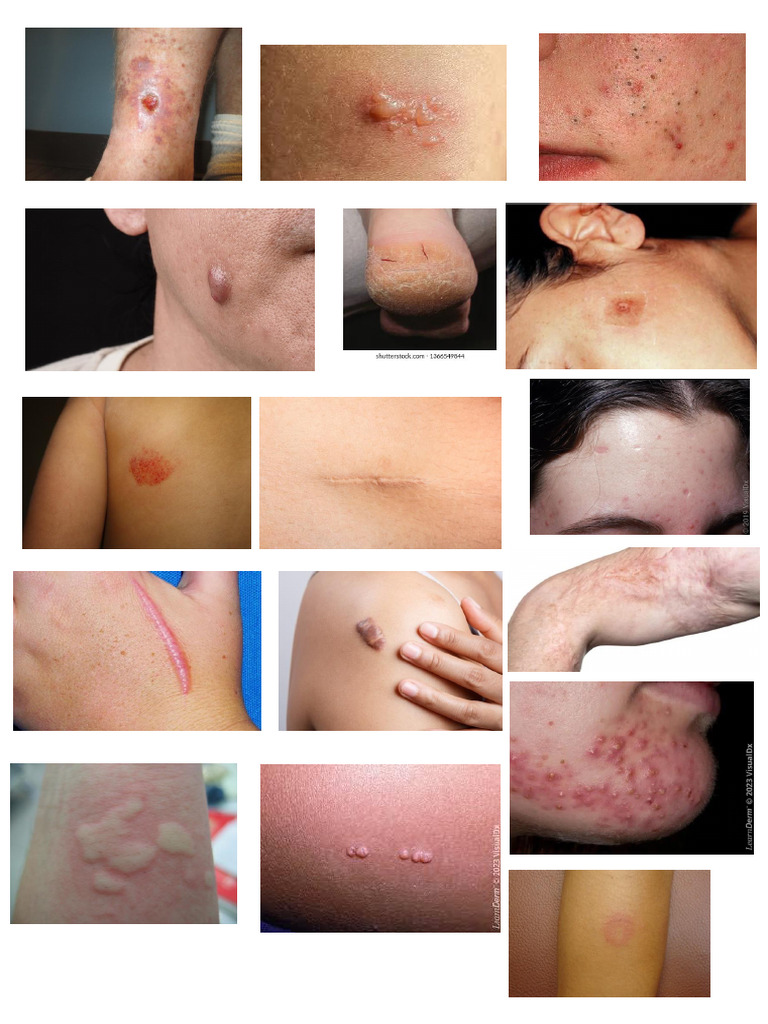 Lesiones Elementales PDF | PDF