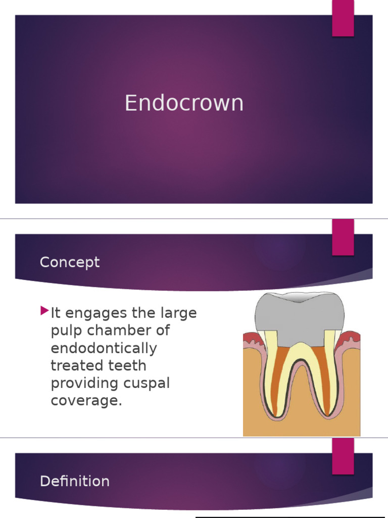 Endodontically Treated Teeth (Endocrown) | PDF | Dentistry Branches ...