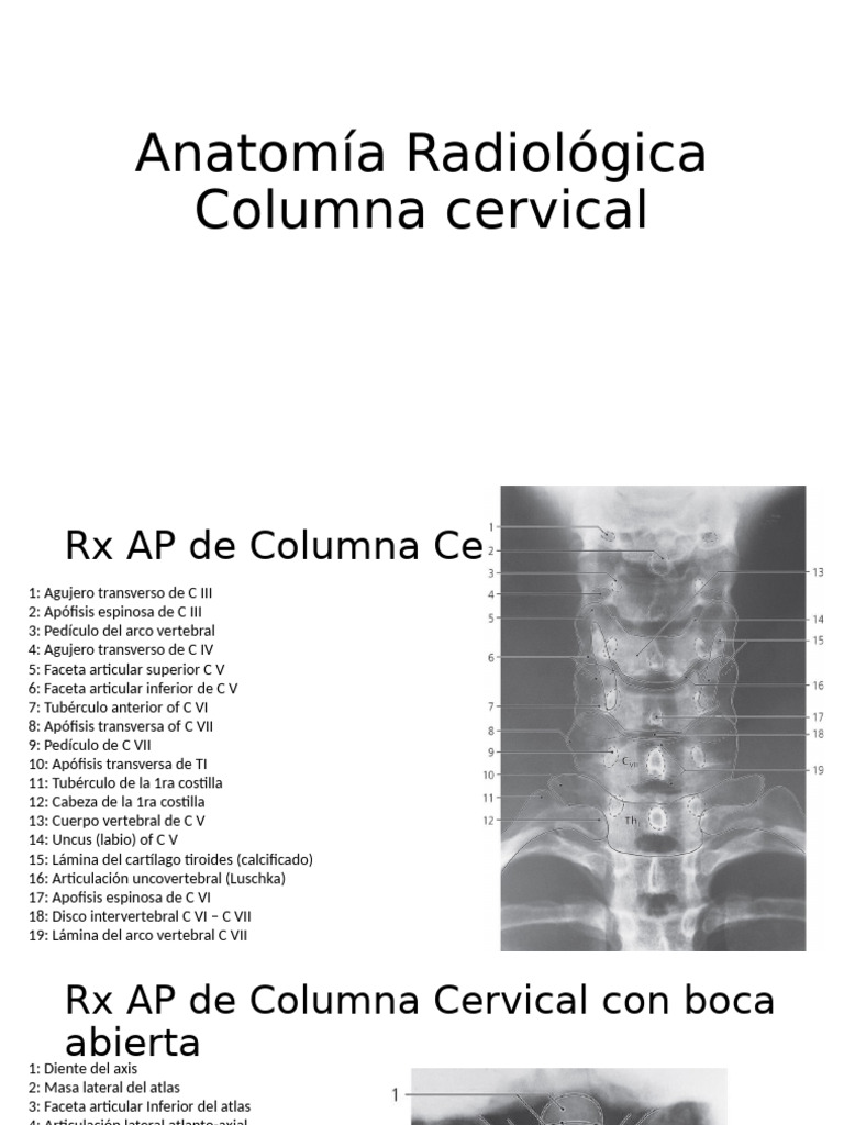 Anatomía Radiológica Columna Cervical | PDF