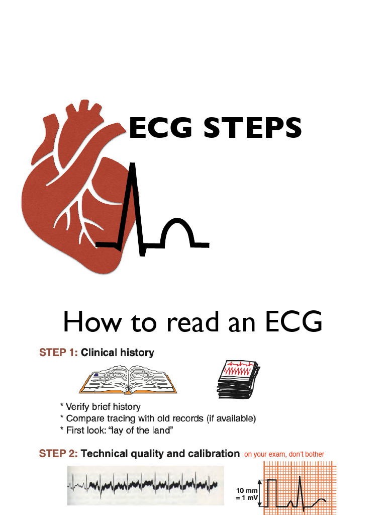 ECG Steps | PDF