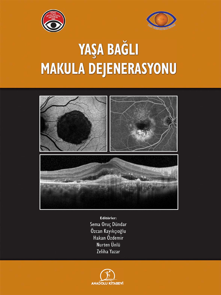4 - Yaşa Bağlı Makula Dejenerasyonu 2022 | PDF
