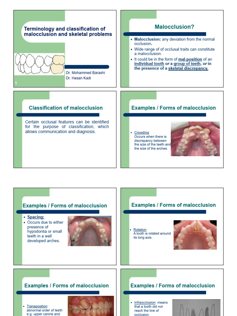 5 - Classification of Malocclusion ??? | PDF | Dentistry | Tooth
