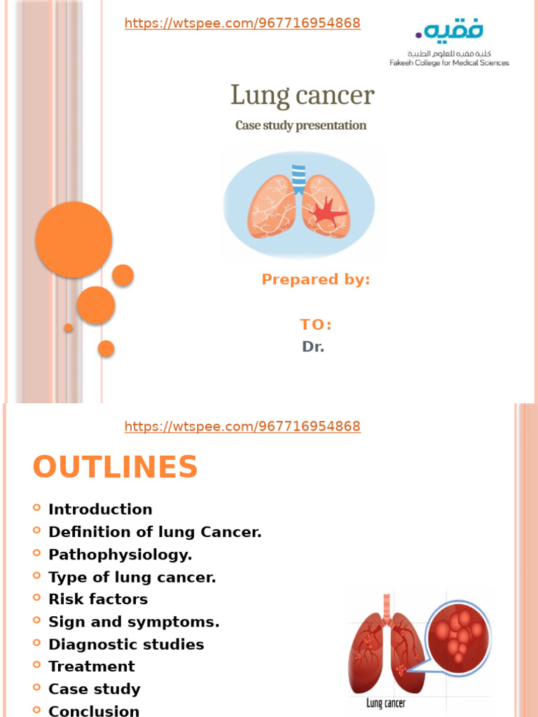 Comprehensive Lung Cancer Case Study | PDF | Lung Cancer | Carcinoma
