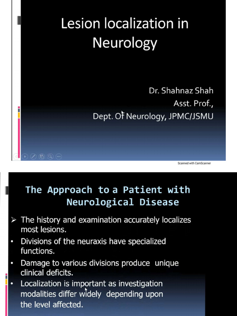 Lesion Localization in Neurology | PDF