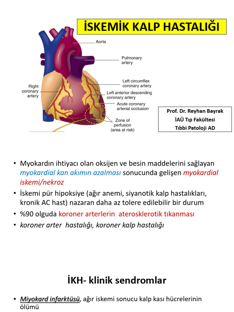 Iskemik Kalp Hastaligi | PDF