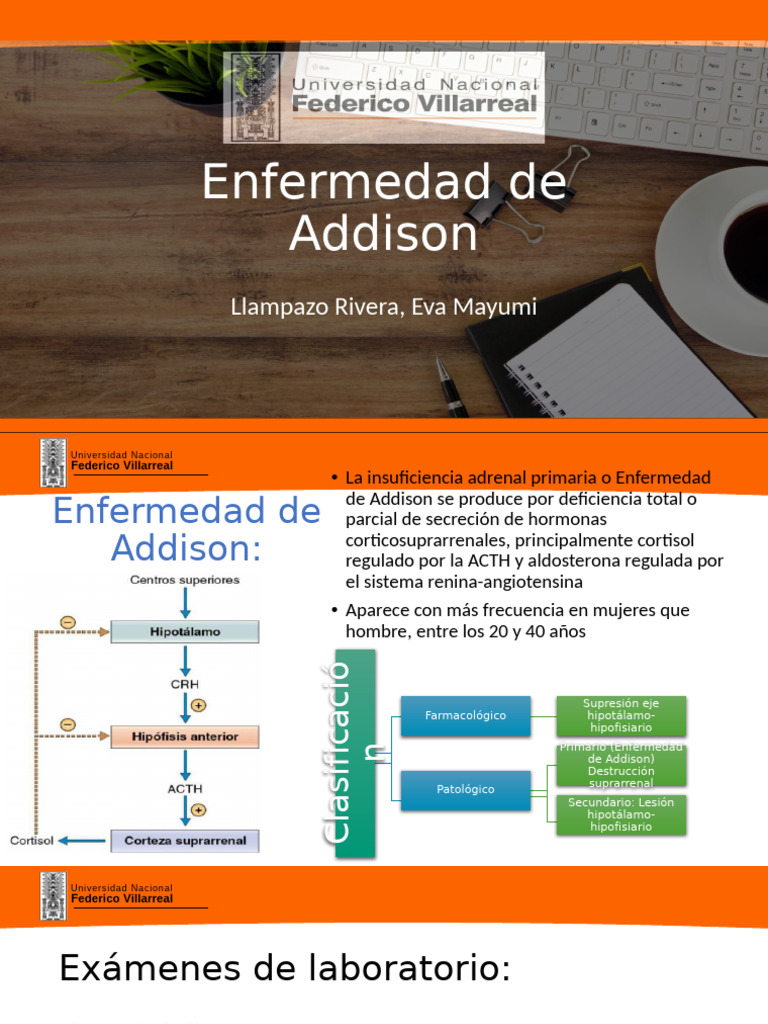 Articulo - Enfermedad de Addison | PDF
