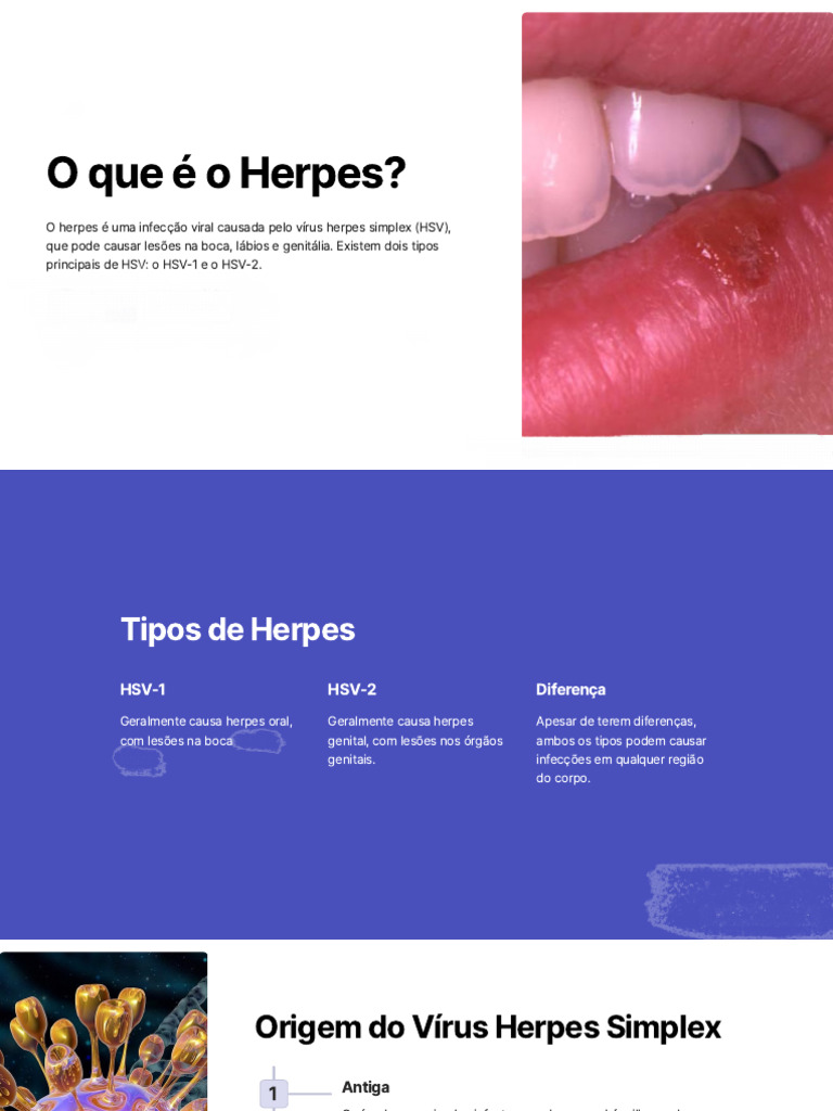 Origem Do Virus Herpes Simplex | PDF | Vírus | Virologia