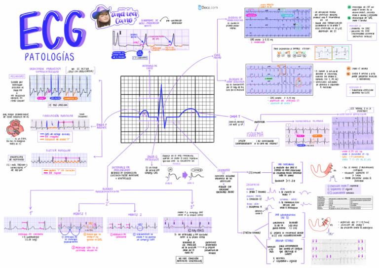 Arritmias en el Electrocardiograma | PDF