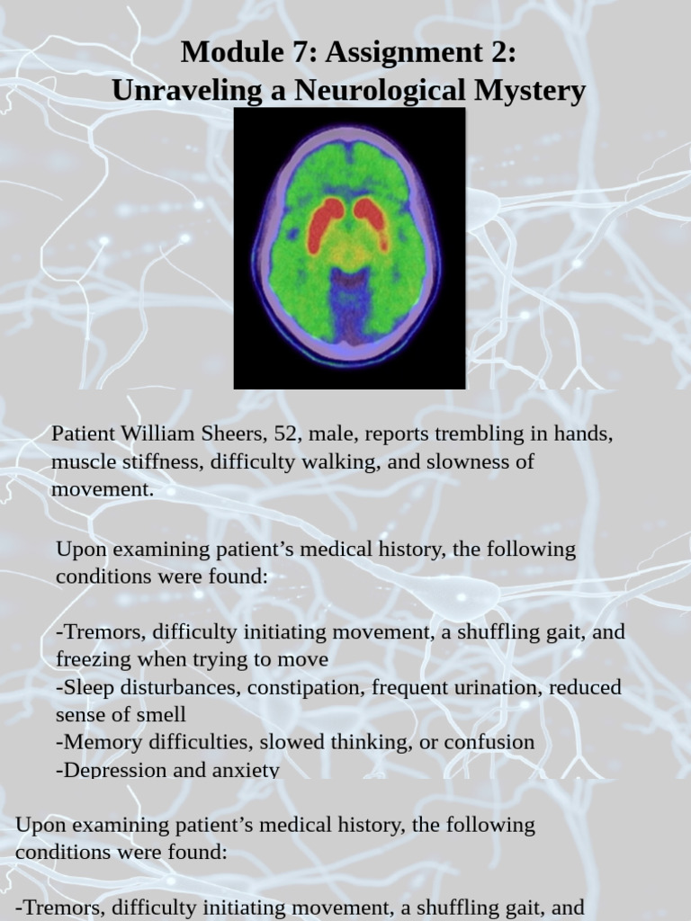 Neurological Mystery | PDF