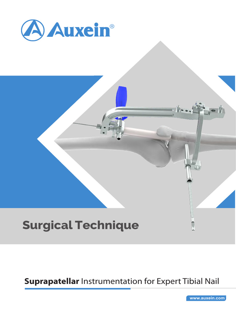 Suprapatellar Instrumentation For Expert Tibial Nail | PDF | Knee | Screw