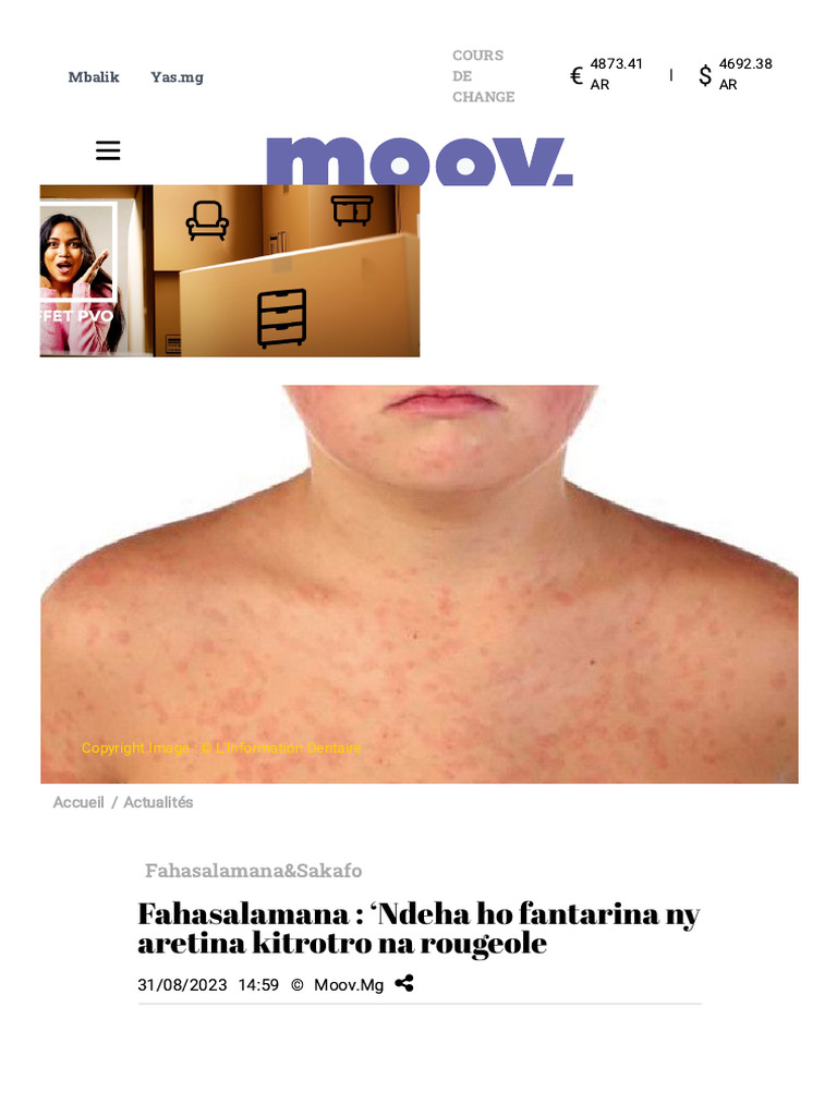 Ireo Zava-Dehibe Tsara Fantatra Mahakasika Ny Aretina Kitrotro | PDF