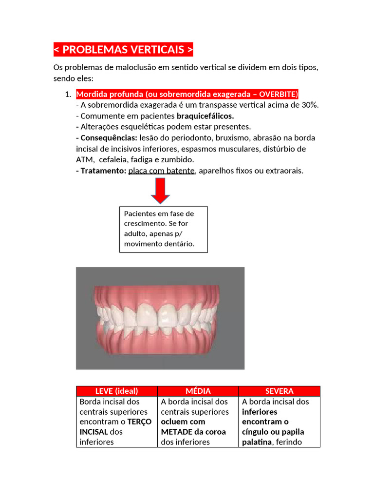 Problemas de Mordida Vertical | PDF