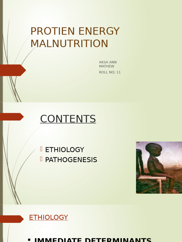 Protien Energy Malnutrition 1 | PDF