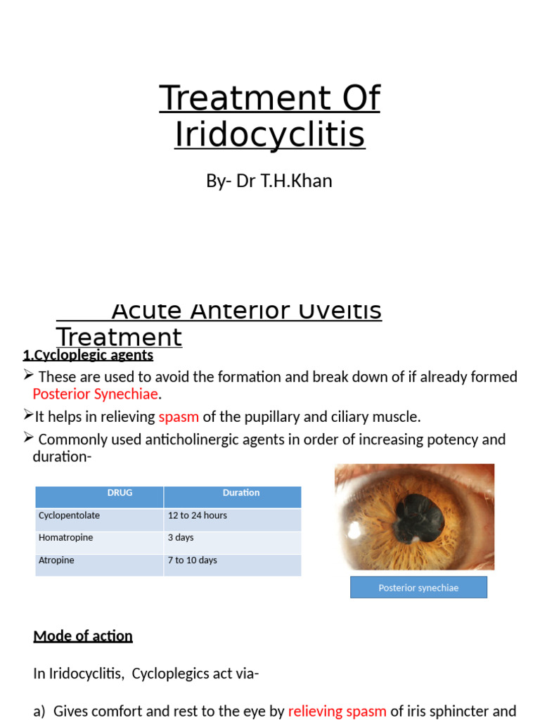 Treatment of Iridocyclitis | PDF | Corticosteroid | Medicine
