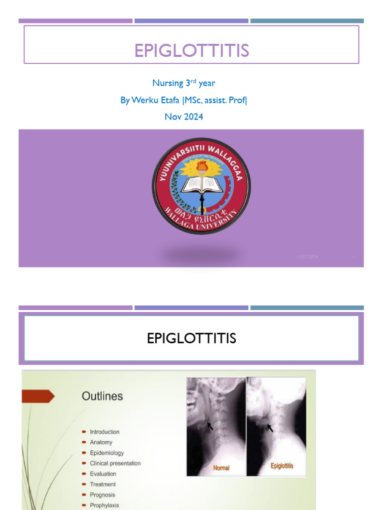 Epiglottitis | PDF