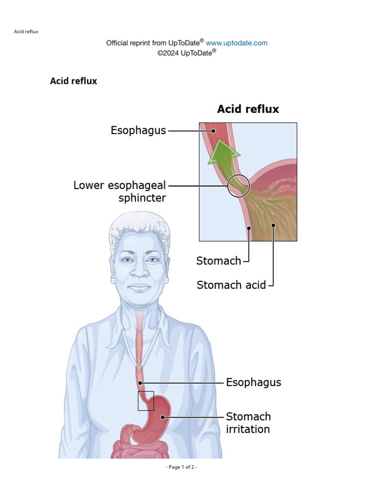 Acid Reflux | PDF