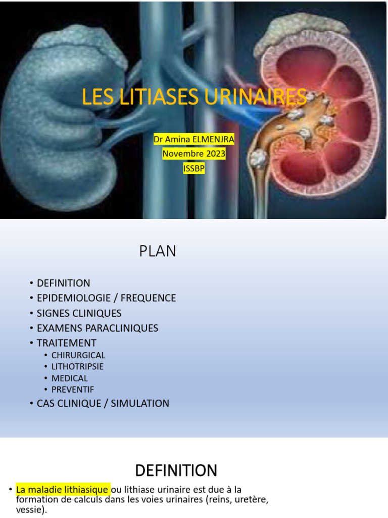 Lithiase Urinaire : Épidémiologie et Traitement | PDF | Calcium ...