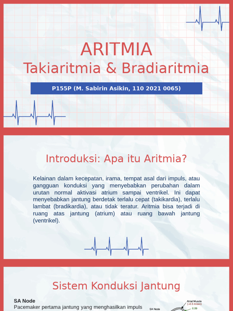 Aritmia (Takiaritmia Dan Bradiaritmia) | PDF