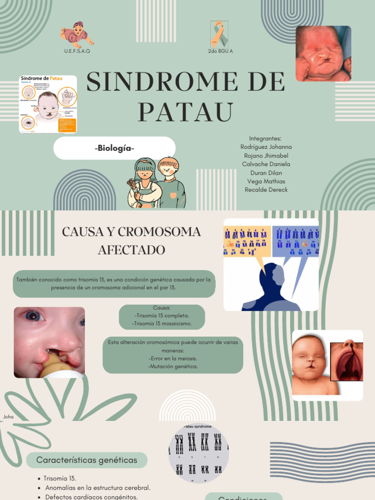 Sindrome de Patau | PDF | Enfermedades y trastornos | Enfermedades y ...
