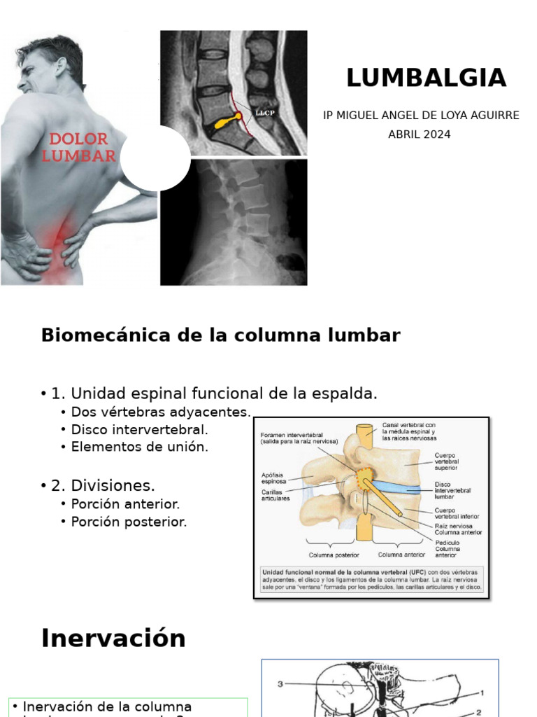 Lumbalgia Mike | PDF | Dolor lumbar | Rodilla