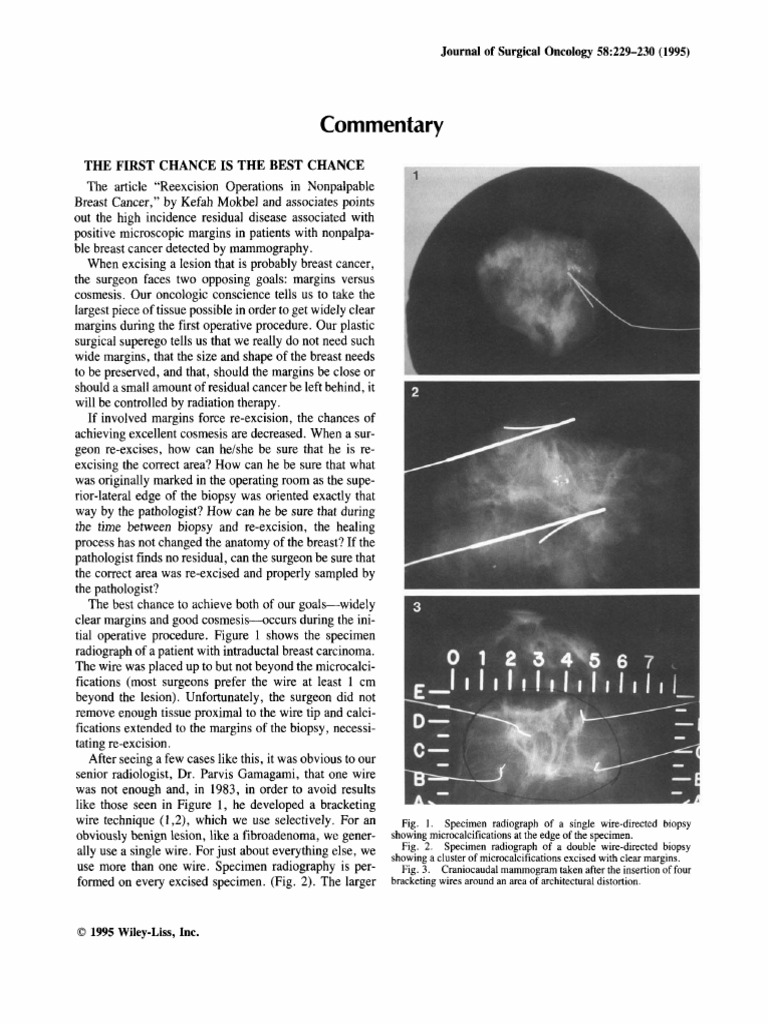 The First Chance Is The Best Chance | PDF | Biopsy | Breast Cancer