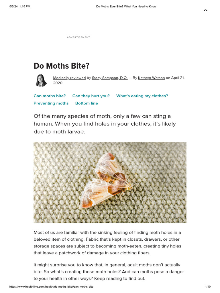 Do Moths Ever Bite_ What You Need to Know | PDF | Moth | Lepidoptera