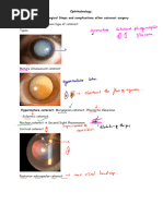 Hyphema vs. Hypopyon: Key Differences | PDF | Corticosteroid | Causes ...