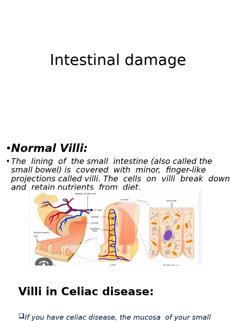 Celiac Disease and Villous Atrophy | PDF